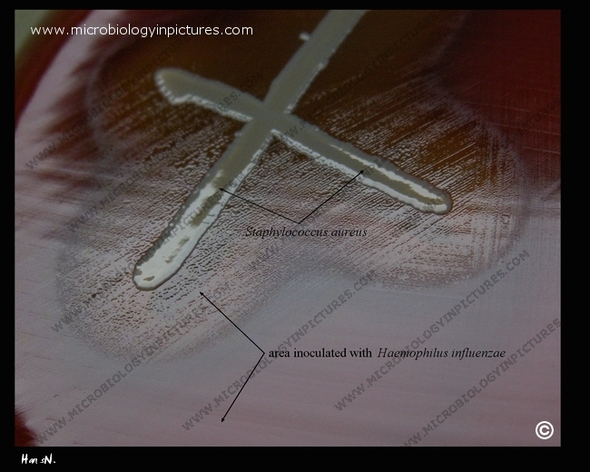 Haemophilus influenzae satellite test - growth around Staphylococcus ...
