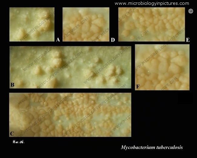 Mycobacterium tuberculosis confluent growth on Löwenstein-Jensen medium.
