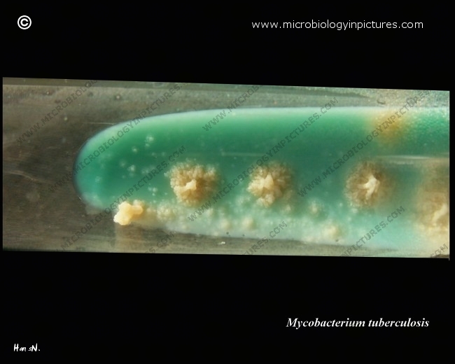 MTB, Mycobacterium tuberculosis growth on solid cultivation media.