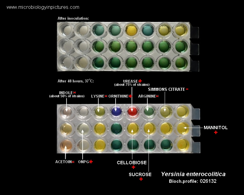 Tests used in the identitification of Yersinia enterocolitica bacteria ... Tests used in the identitification of Yersinia enterocolitica bacteria ...