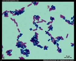 Staphylococcus aureus images, colony morphology and tests for ...