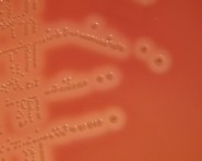 Streptococcus agalactiae under microscope, Group B streptococcus or GBS ...