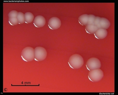 Images of bacteria - gallery of bacteria. Images of medically important ...
