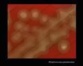 Streptococcus pneumoniae colony morphology and microscopic appearance ...